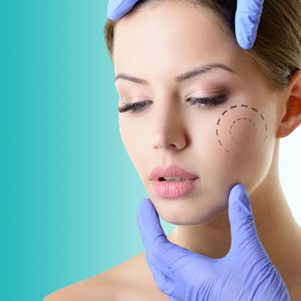 Bichectomía - ClínicaEssenza